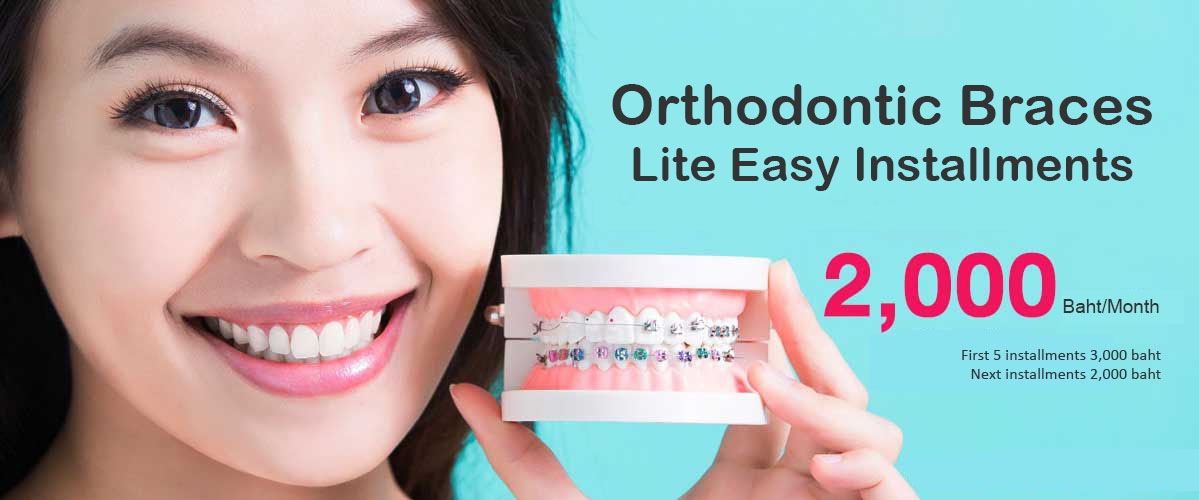 Dental Promotions Smile Signature Dental Packages 2022