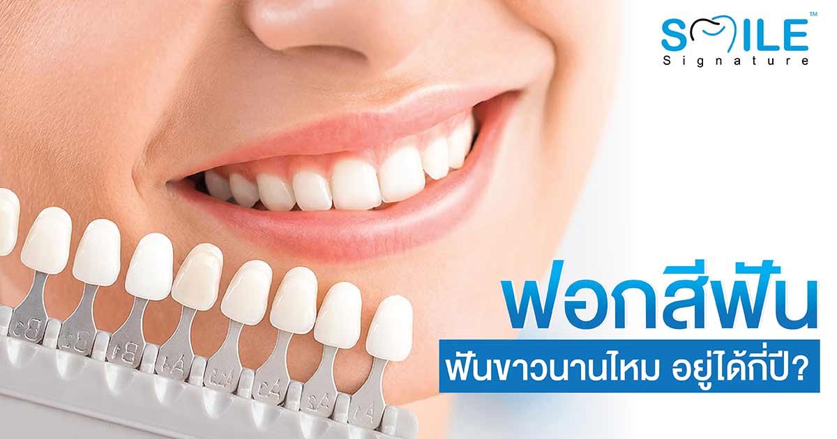 ฟอกสีฟัน ฟันขาวนานไหม อยู่ได้กี่ปี? | Smile Signature คลินิกทำฟัน